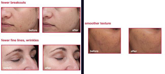 Beauty Lodge | Dermalogica Pro Power Peel 60 | Health and Beauty Clinic